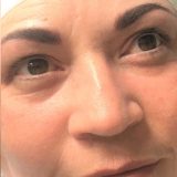 Berkshire Permanent Makeup by Dr Ellie Dyson - FREE Consultation