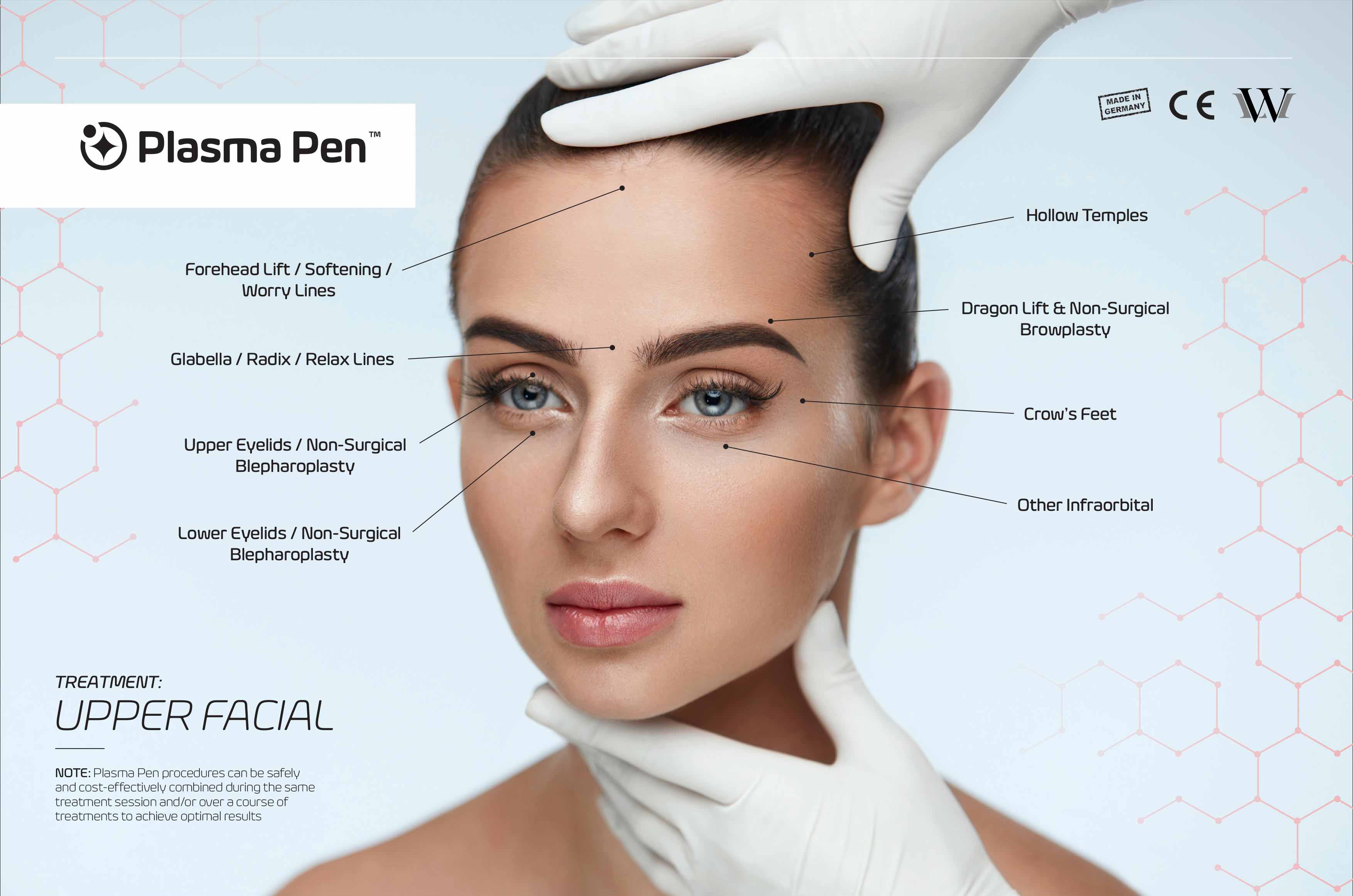 Plasma Skin Tightening Bespoke by Dr Eillie - Free Consultation